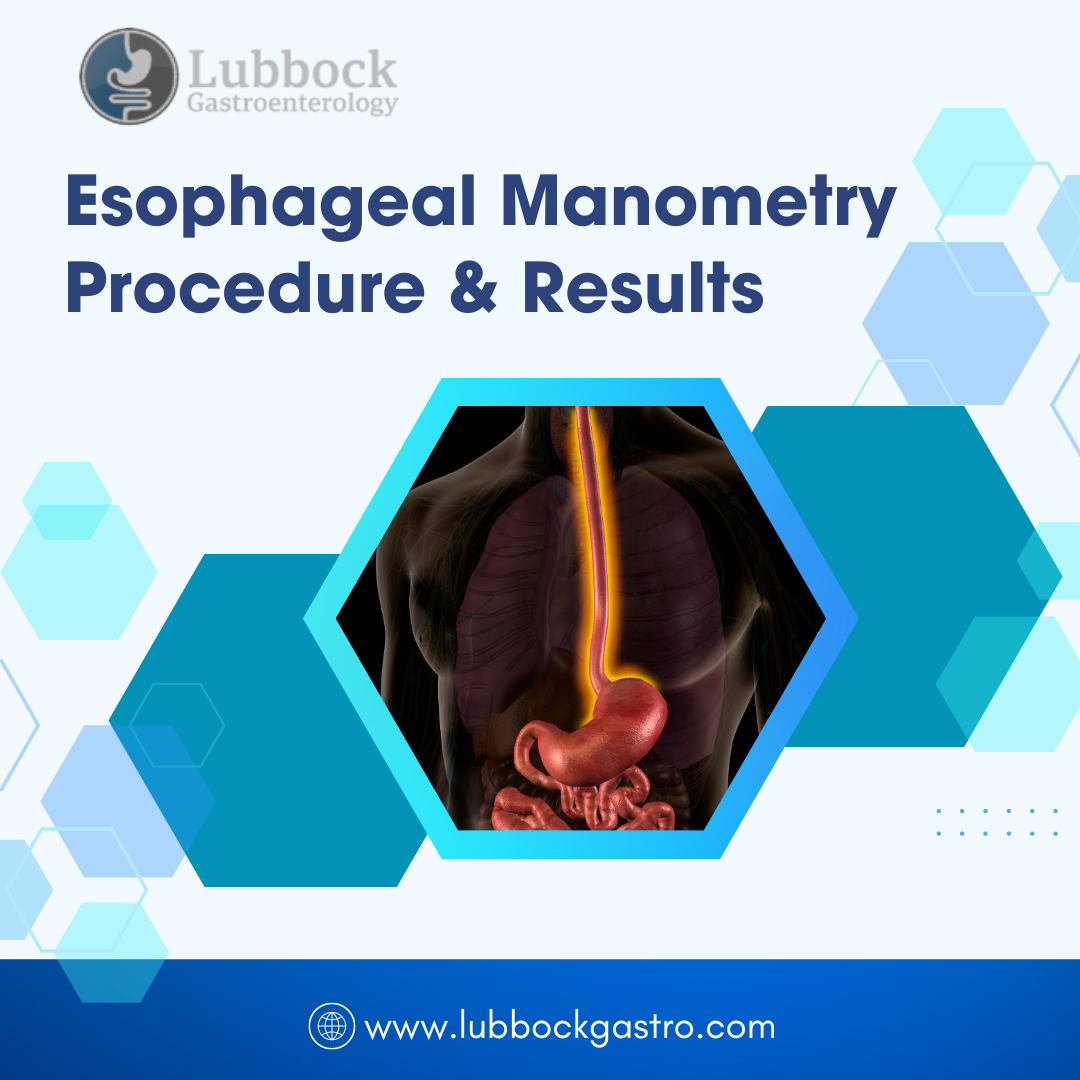 Esophageal Manometry Lubbock TX Procedure Results